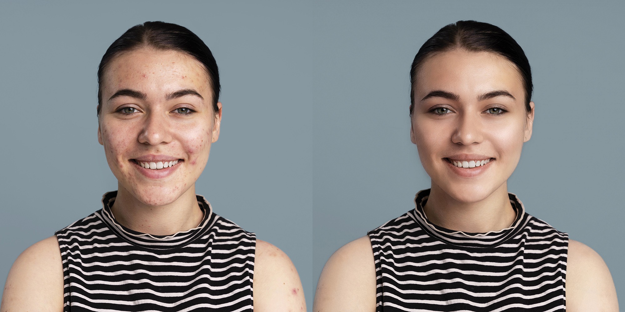 The Art of Professional Skin Smoothing and Retouching – Stephen Davies ...