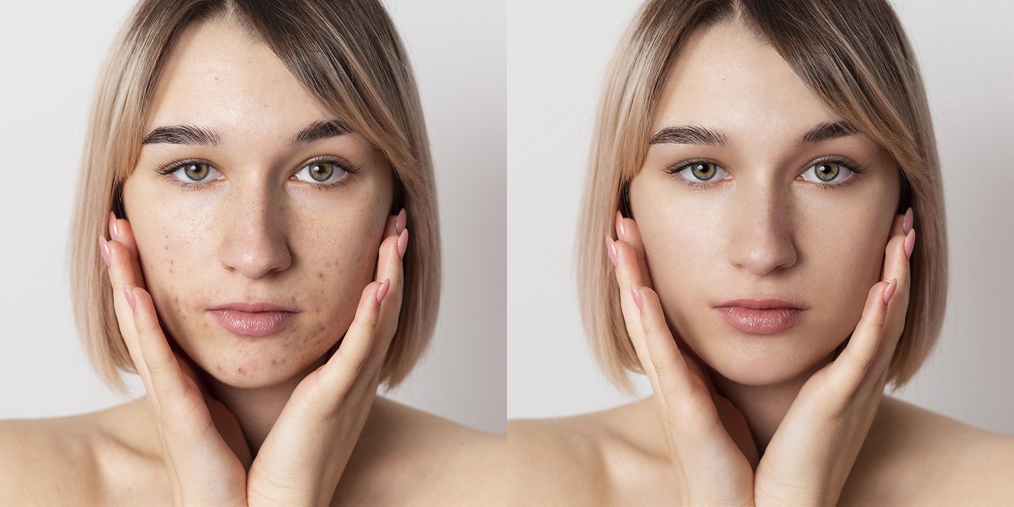 The Art of Professional Skin Smoothing and Retouching – Stephen Davies ...